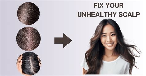 How To Choose The Right Shampoo All Scalp Types