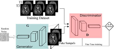 Figure 1 From Brain Mri Technics Images Translation By Generative Adversarial Network Semantic