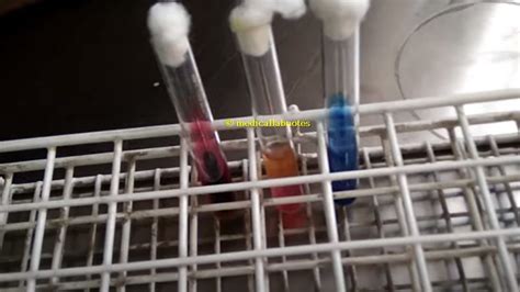 Proteus Mirabilis Introduction Identification Features Keynotes And Proteus Footages