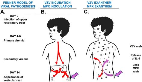 Chicken Pox Virus Diagram