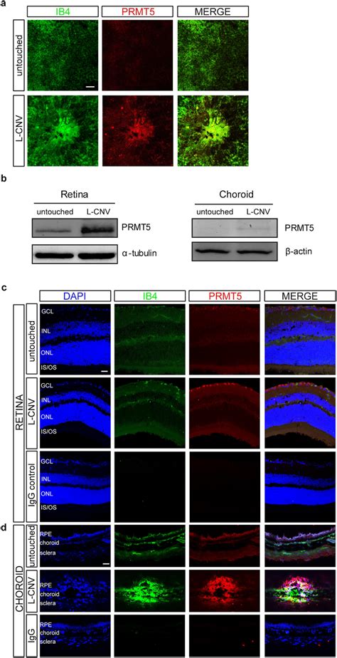 Prmt5 Expression In Murine Laser Induced Choroidal Neovascularization Download Scientific