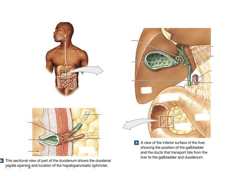 The Gallbladder Quiz