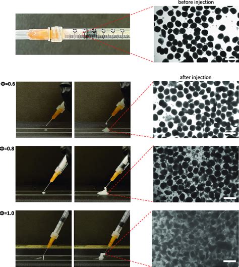 Injectability Of Amorphous Solid Igg Laden Alginate Hydrogel Particles