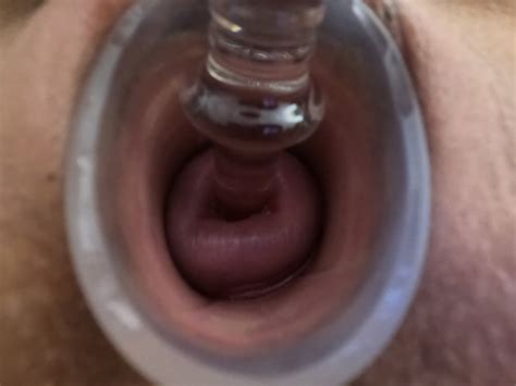 Cervix Gallery 5 Pics Xhamster