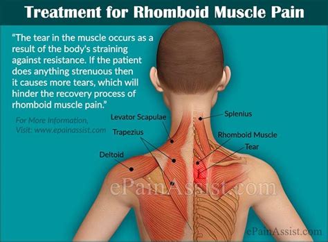 Pin On Arthritis Psoriatic