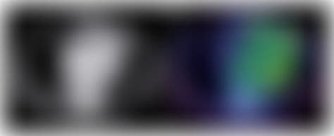 Cardiac Mesothelioma Rsubarnavilladotcom