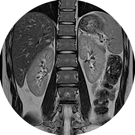 ام آر آی 15 تسلا دکتر قائمیان مرکز تصویر برداری پزشکی دکتر قائمیان