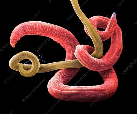 Parasitic Roundworms Sem Stock Image C0370816 Science Photo Library