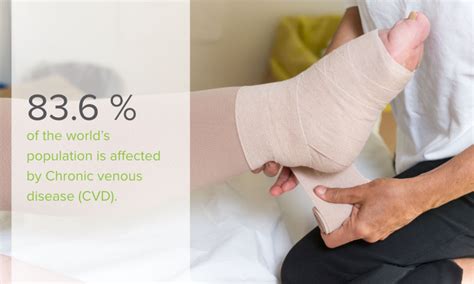 Abi In Compression Therapy