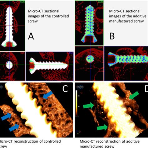 Comparison Of Micro Ct Sectional Images A And B And Reconstruction