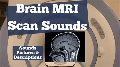 Mri Scan Sounds Explained Exploring Brain Mri Scan Sounds And Protocols Youtube