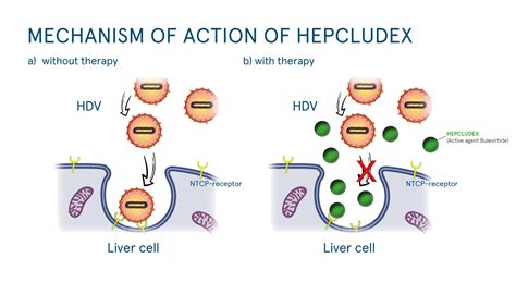 Hepcludex First Drug For Hepatitis D Has Been Approved German Center