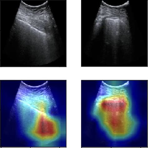 gradient class activation maps for each class left to right download scientific diagram