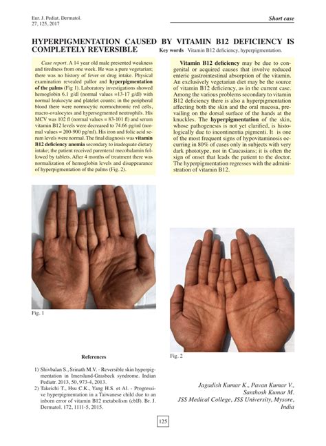 Vitamin B Deficiency Nails Nail Ftempo