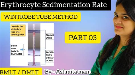 Wintrobe Method Esr Hematology Bmlt Dmlt Youtube