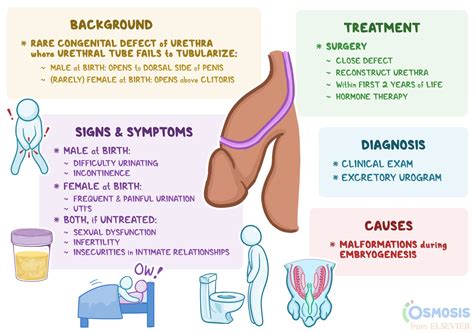 Dsd Cavernous Meaning Medical Patient