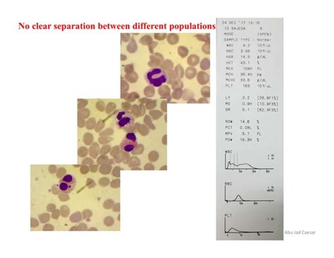 Wbc Histogram