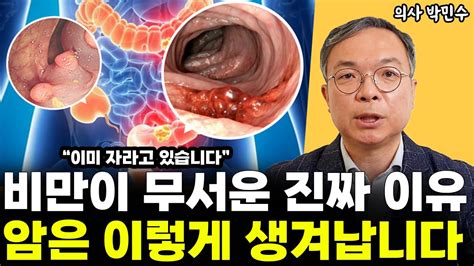 살찌면 치명적인 암이 늘어나는 진짜 이유 L의사 박민수 4부 Youtube