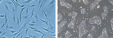 Ipsc Technology Nexel Korean Ipsc Derived Cells Provider