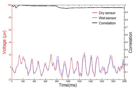 The Eeg Signals And Their Correlation Analysis On The Forehead Site Download Scientific Diagram