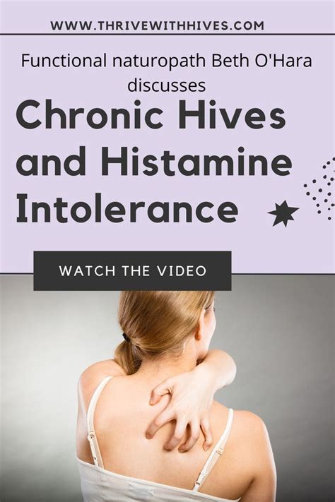 Chronic Hives Histamine Intolerance And Mold Chronic Hives Chronic