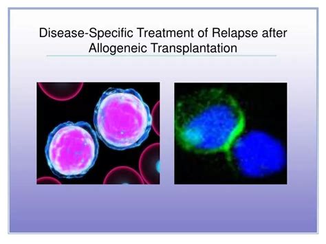 Ppt Disease Specific Treatment Of Relapse After Allogeneic Transplantation Powerpoint