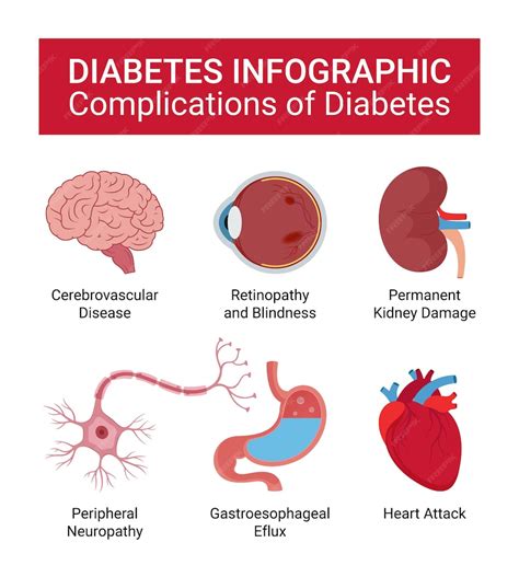 Infografías Médicas De Las Complicaciones De La Enfermedad De La