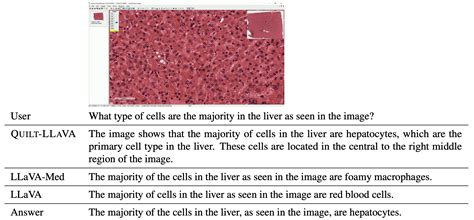 Quilt Llava Visual Instruction Tuning By Extracting Localized