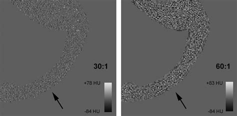 the images demonstrate pixel intensity differences between the lossless