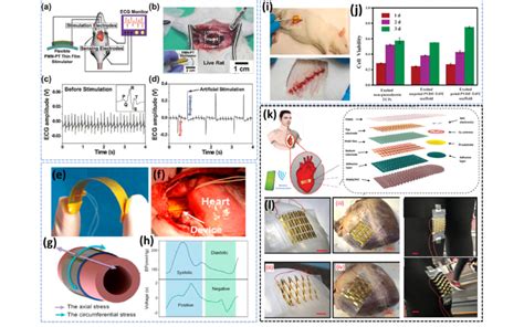 Stretchable Pmn Pt Thin Film Self Powered Cardiac Pacemaker A An Download Scientific Diagram