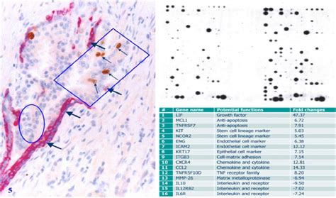 Gene Expression Profiling Of Cells Overlying Focally Disrupted And