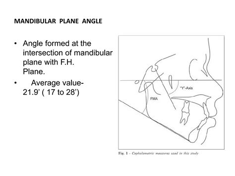 Cephalometric Analysis Pptx