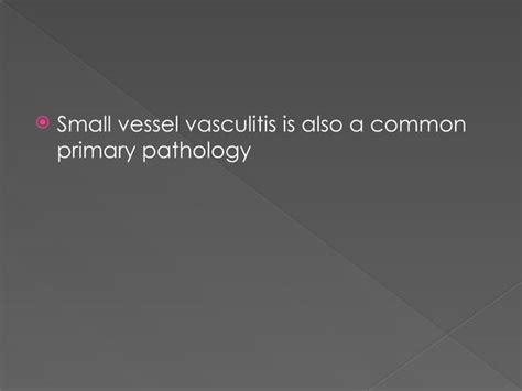 Approach To Management Of Sle Patients Pptx