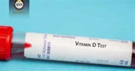 نصائح مهمة من هيئة الدواء حول نقص فيتامين د تعرف عليها الأخبار