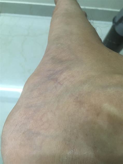 EXPLAINER Lab Results And Their Interpretation By Ethan What Do My Lab Results Mean