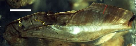 Otolith Section Image For A 145 Cm Female Wcsi August Estimated To