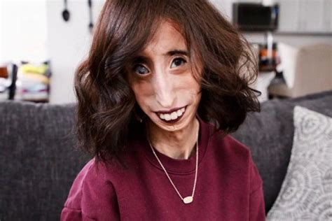 მე ყველაზე მახინჯი გოგო ვარ მსოფლიოში ცნობილი ლიზი ველასკესის 16 ფოტო