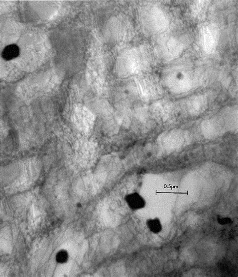 Tem Image Showing Coherency Strain Field Contrast At The Precipitateni