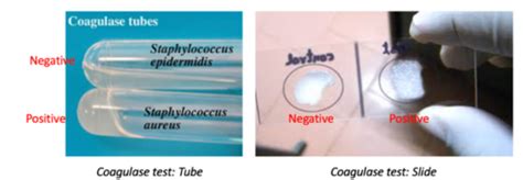 Lab Exam 4 Flashcards Quizlet