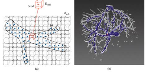 Figure 1 From An Improved Fuzzy Connectedness Method For Automatic Three Dimensional Liver