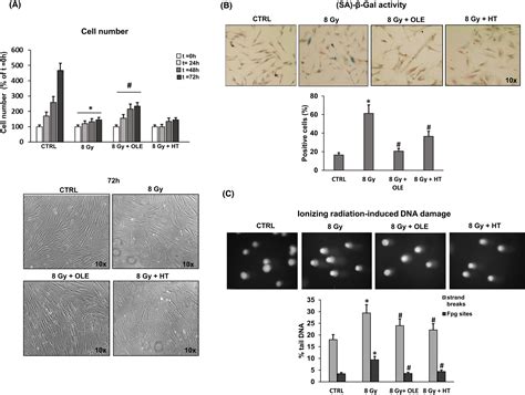 Olive Phenols Preserve Lamin B1 Expression Reducing Cgas Sting Nfκb