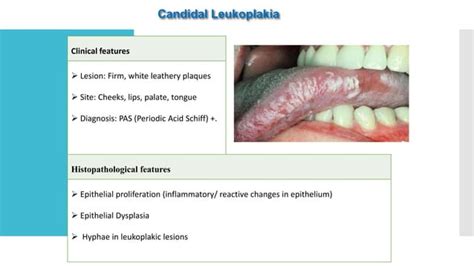 Pre Cancerous Lesion And Condition