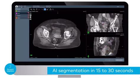 Varian On Linkedin Join Us For An Innovation Hub Presentation At 345 445pm Est On Varian