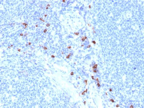 Tryptase Mast Cell Marker Monoclonal Antibody Tpsab1 1963 7177