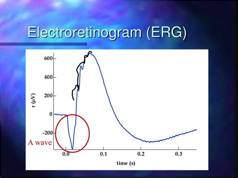 Ppt Electroretinogram An Electrical Diagnostic Test Of Retinal