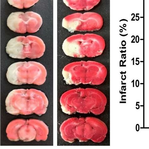 Figure 2 From Neuroprotection By Hypercapnia In Brain Ischemic Injury