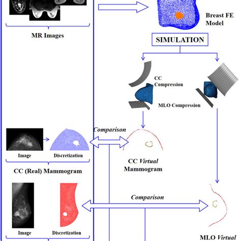 Scheme Showing The Patient Based Fe Simulation Methodology Described In