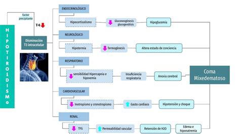 Hipotiroidismo Jheniffer Udocz