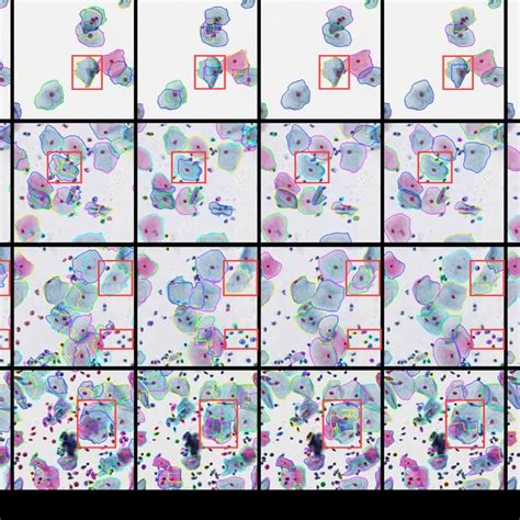 Pdf Irnet Instance Relation Network For Overlapping Cervical Cell
