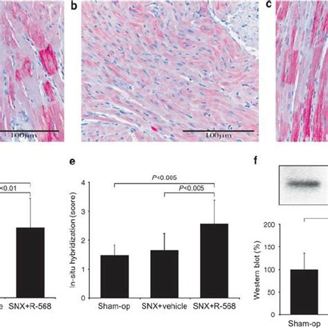 Capillary Length Density And B Intercapillary Distance In The Right